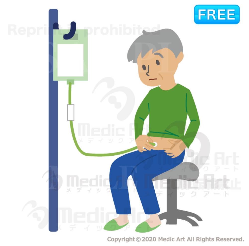 The gastric fistula (PEG: Percutaneous Endoscopic Gastrostomy)/F1