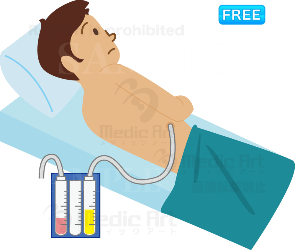Patient with abdominal cavity drain, / F1