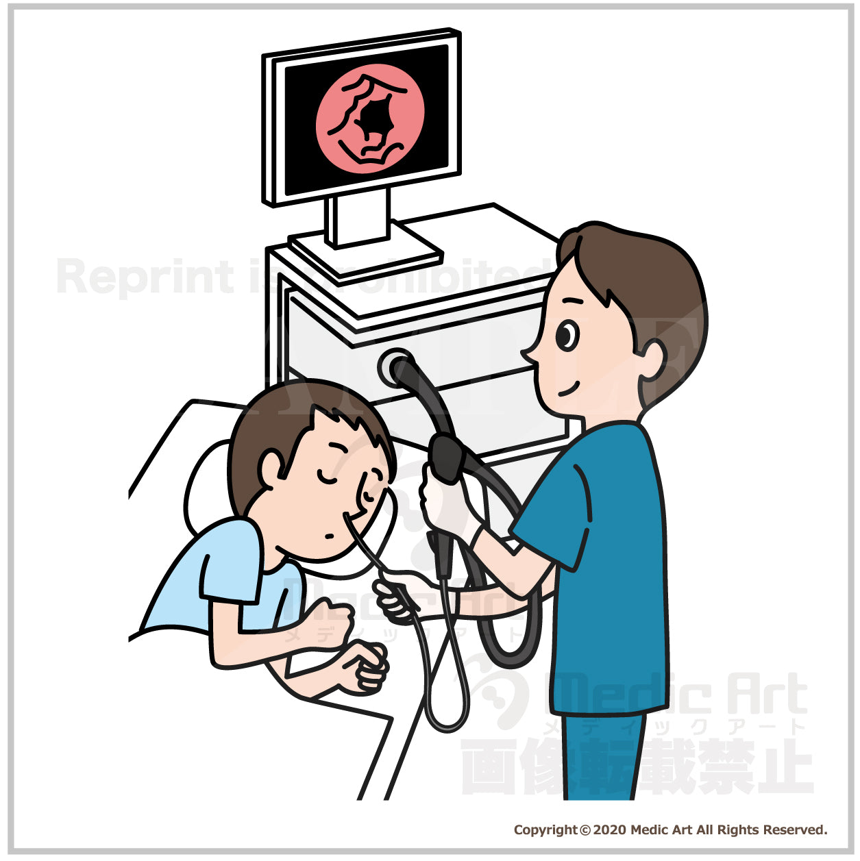 Stomach endoscopic examination (stomach camera)